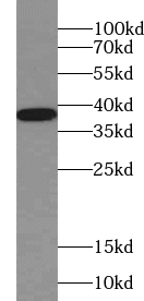 UBE4A antibody|UBE4A抗体价格,详情介绍-960化工网 – 960化工网